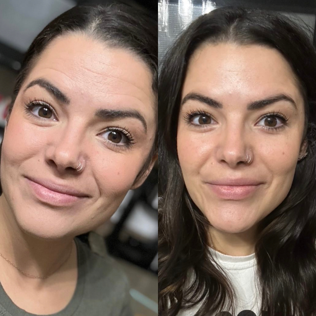 Frownies | The Original Wrinkle Patch