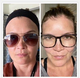 Frownies | The Original Wrinkle Patch | Plant-Based Skincare