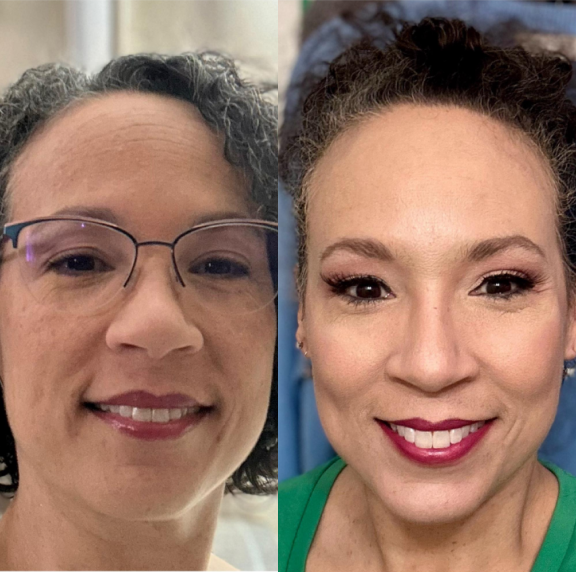 Frownies | The Original Wrinkle Patch